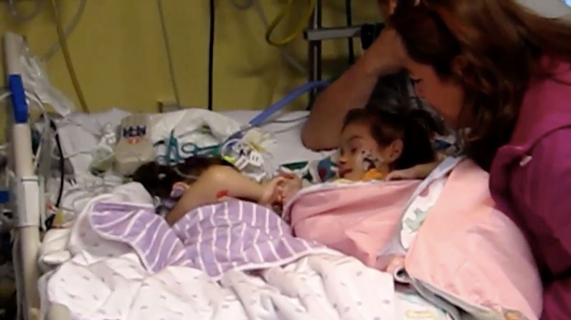 Watch the moment formerly conjoined twins meet for the first time since ...